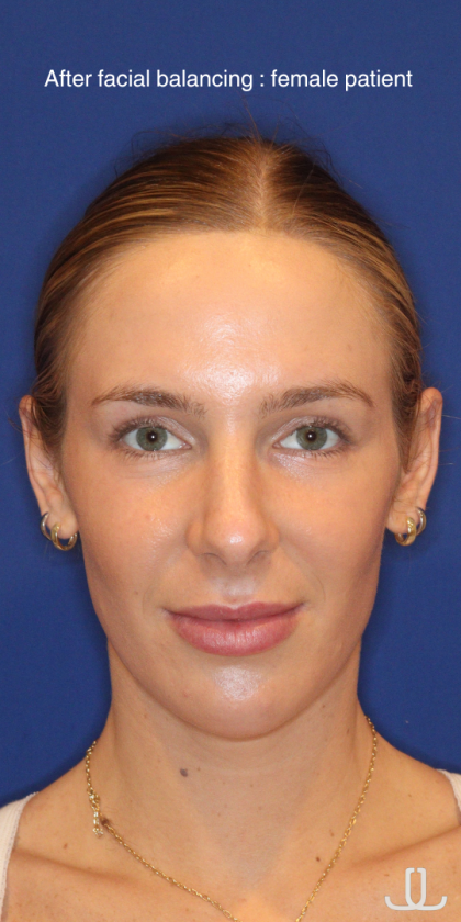 Best Facial Balancing NYC | Dr. Jennifer Levine