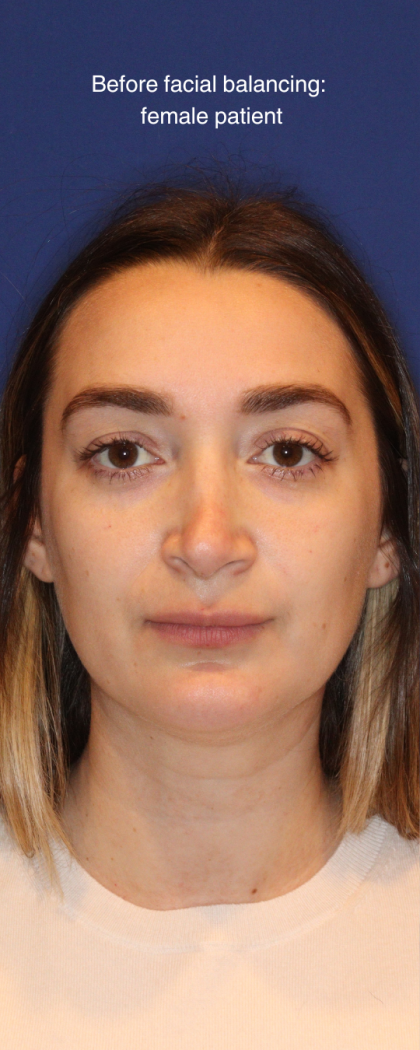 Best Facial Balancing NYC | Dr. Jennifer Levine